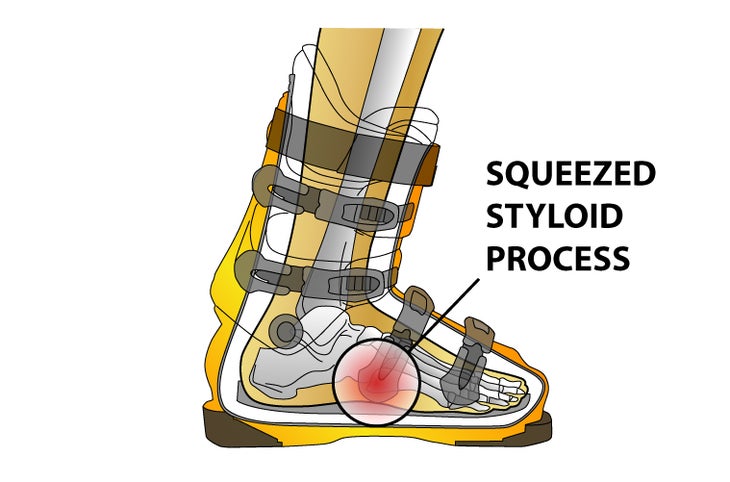 Bootfitting: 10 Common Problems and Solutions